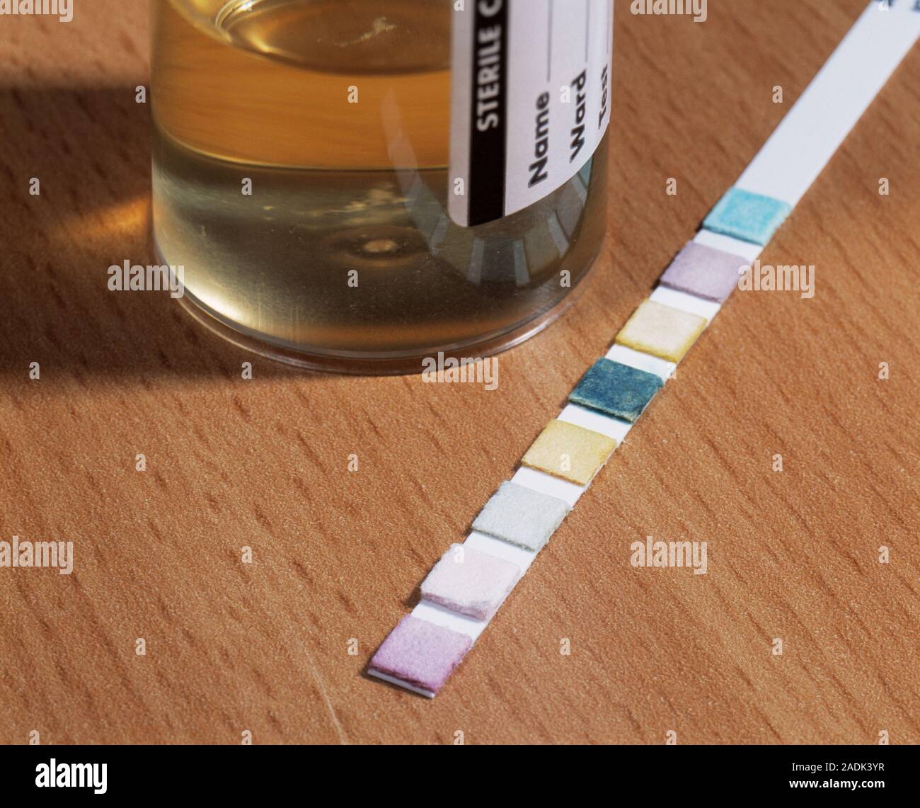 Urine analysis. Multiple test stick, showing the results from being ...
