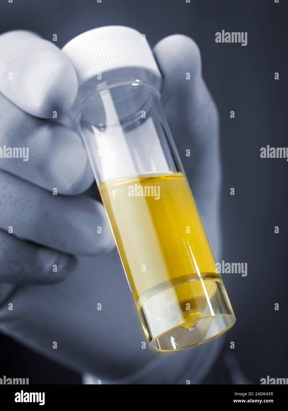 Urine sample. Laboratory technician holding a sample tube containing a ...