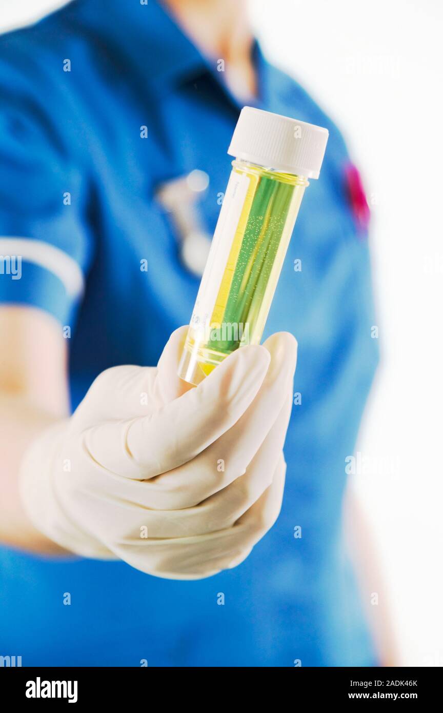 Urine sample. Nurse holding a urine sample tube in a gloved hand Stock ...