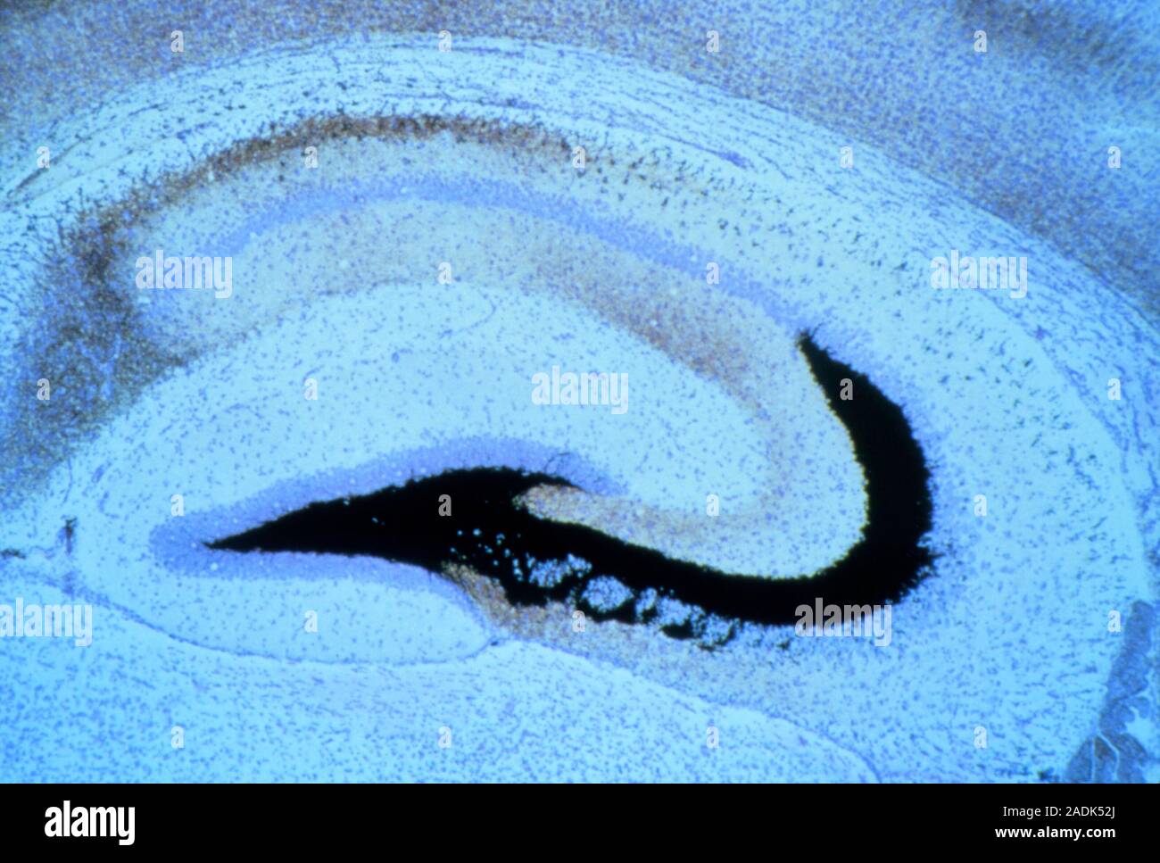 Sheep brain with scrapie. Light micrograph of a sagittal section ...