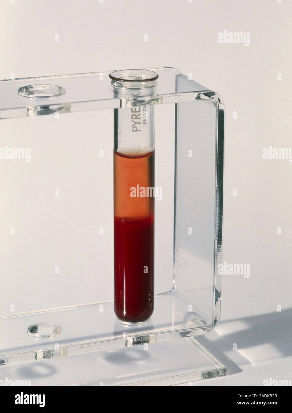 Sheep's blood. Centrifuged sample of sheep's blood in a test tube. The ...