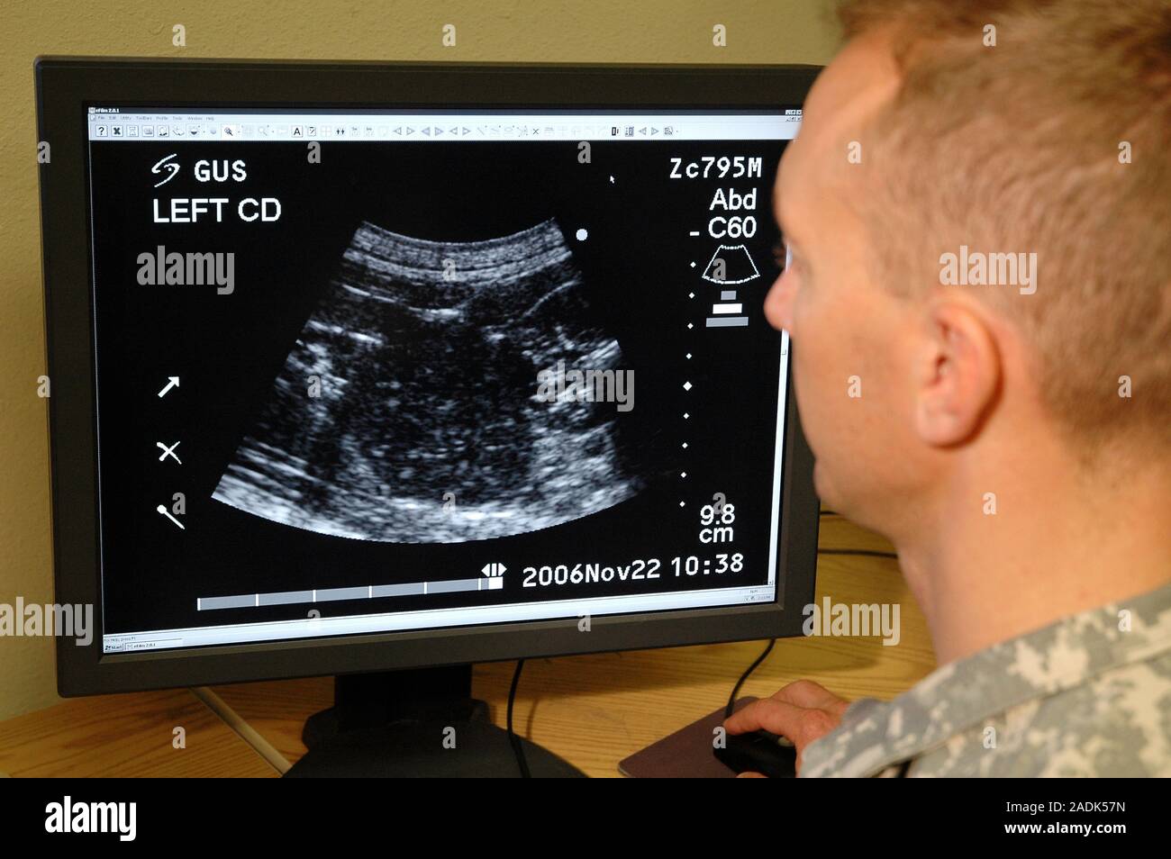 Dolphin ultrasound. Technician examining the ultrasound scan from a ...