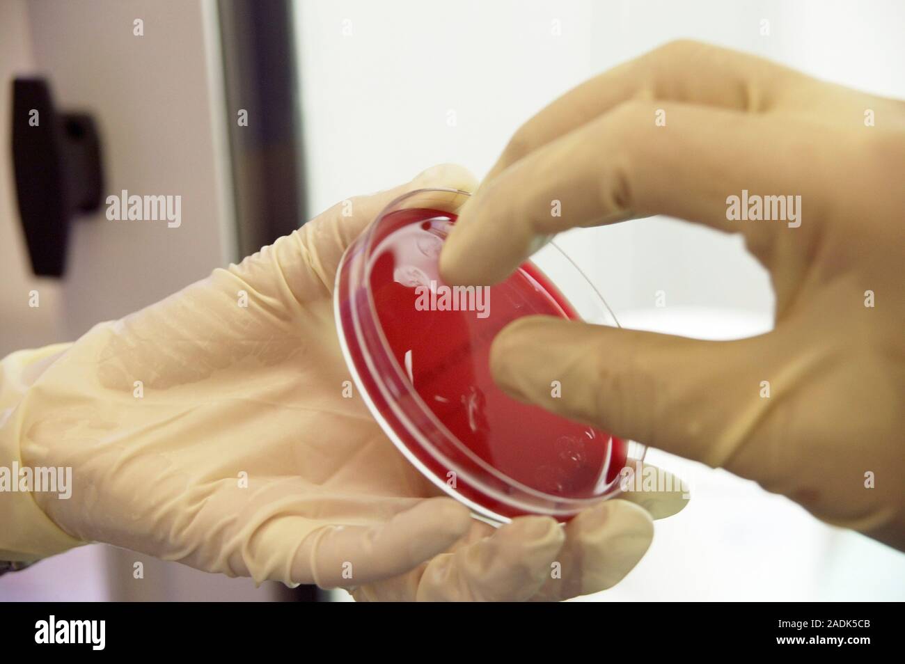 Tissue bank. Bacterial contamination monitoring in a tissue bank. A ...