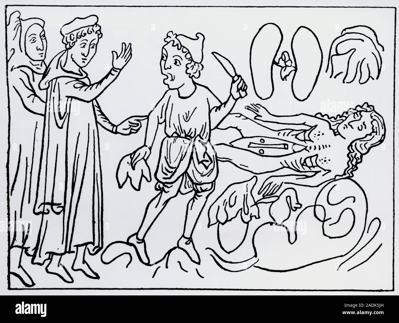 Human dissection, 14th Century style. This image is the earliest known ...