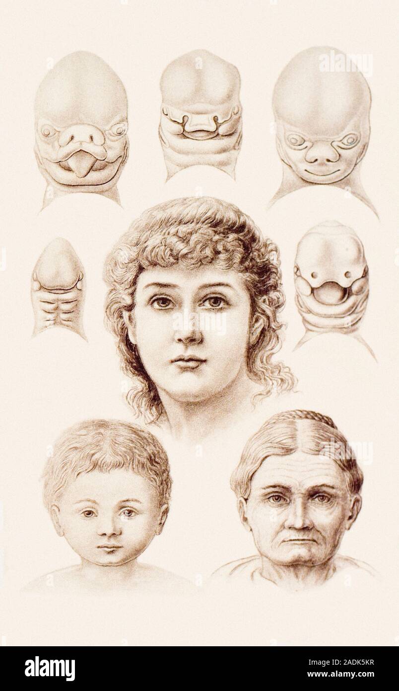 Development of the human face. Historical artwork by Ernst Haeckel ...