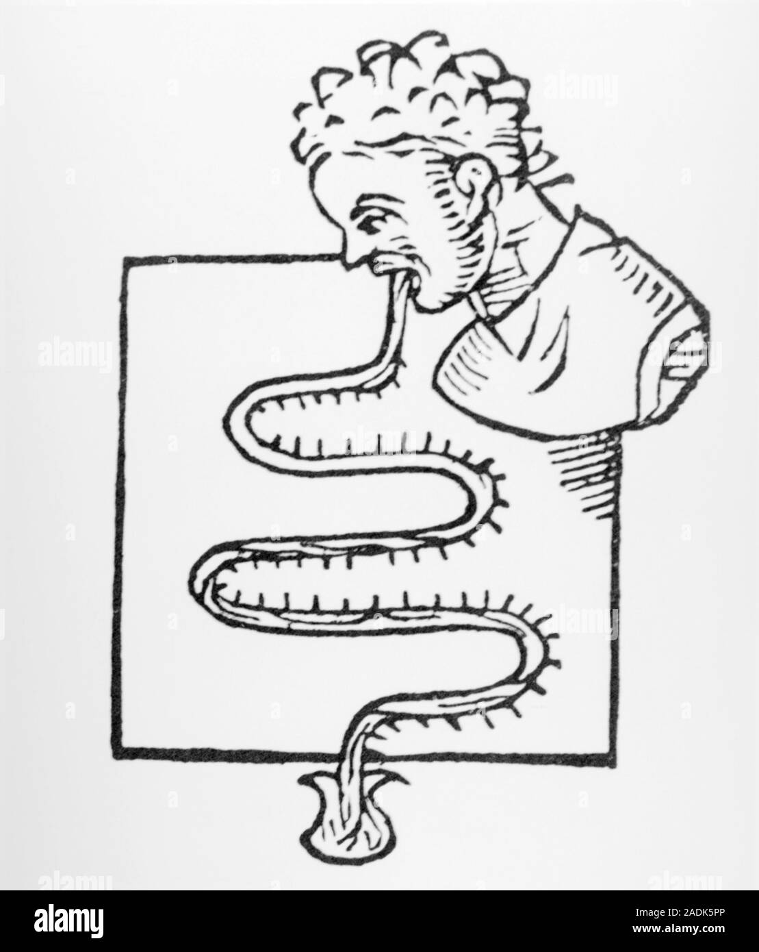 Thermoscope. Artwork of a patient using a thermoscope or early ...