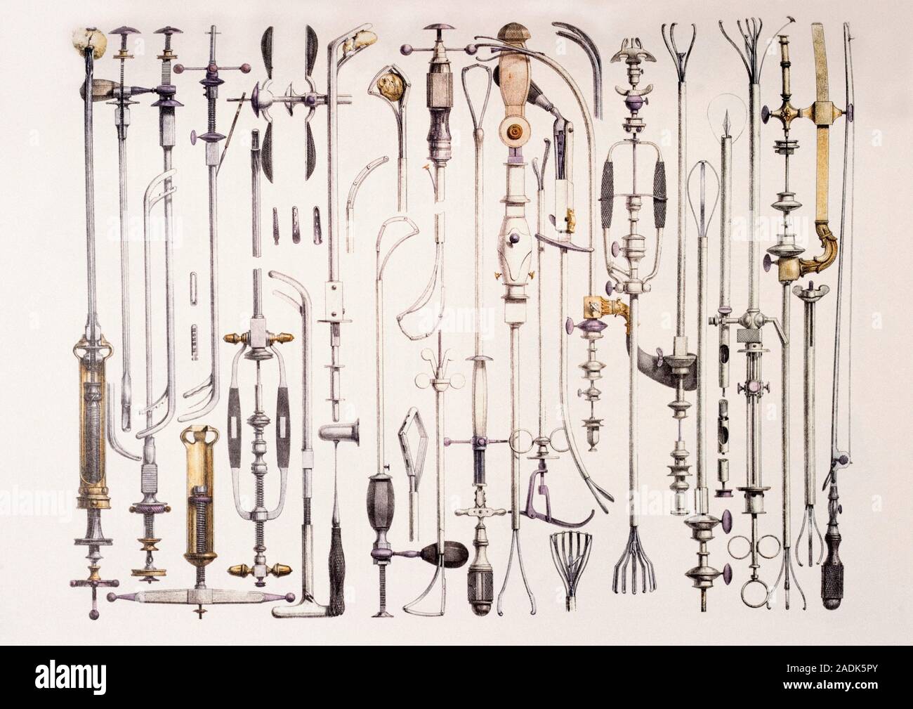 Surgical instruments, historical anatomical artwork. This 19th century ...