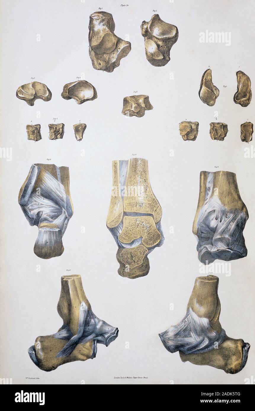 Ankle bones and ligaments. Historical anatomical artwork of ankle bones ...