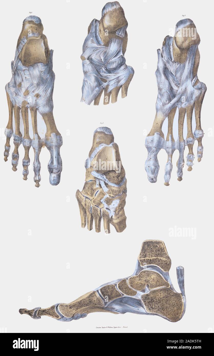 Foot bones and ligaments. Historical anatomical artwork of foot bones ...