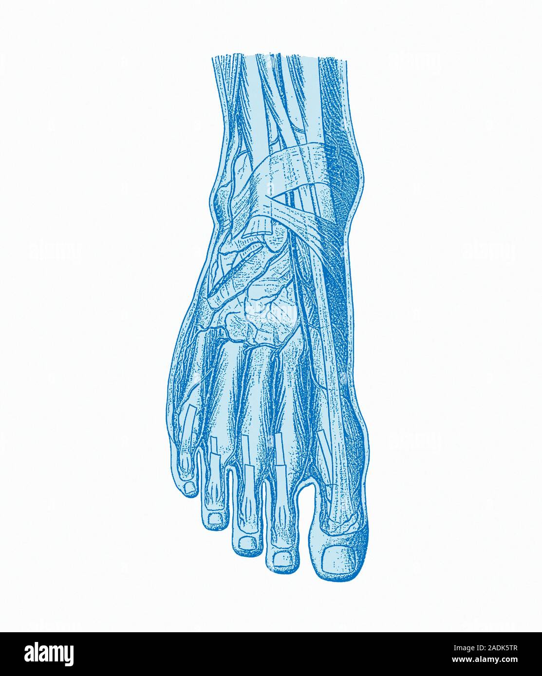 Foot bones and tendons. Historical artwork of a human foot that has ...