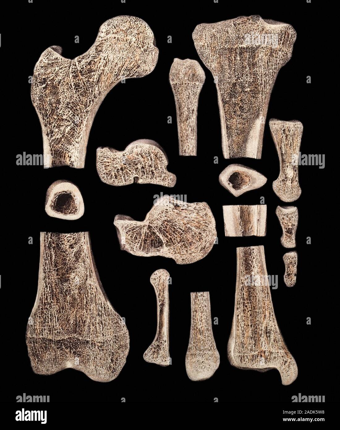 Inner structure of bones, historical anatomical artwork. Bone can be ...