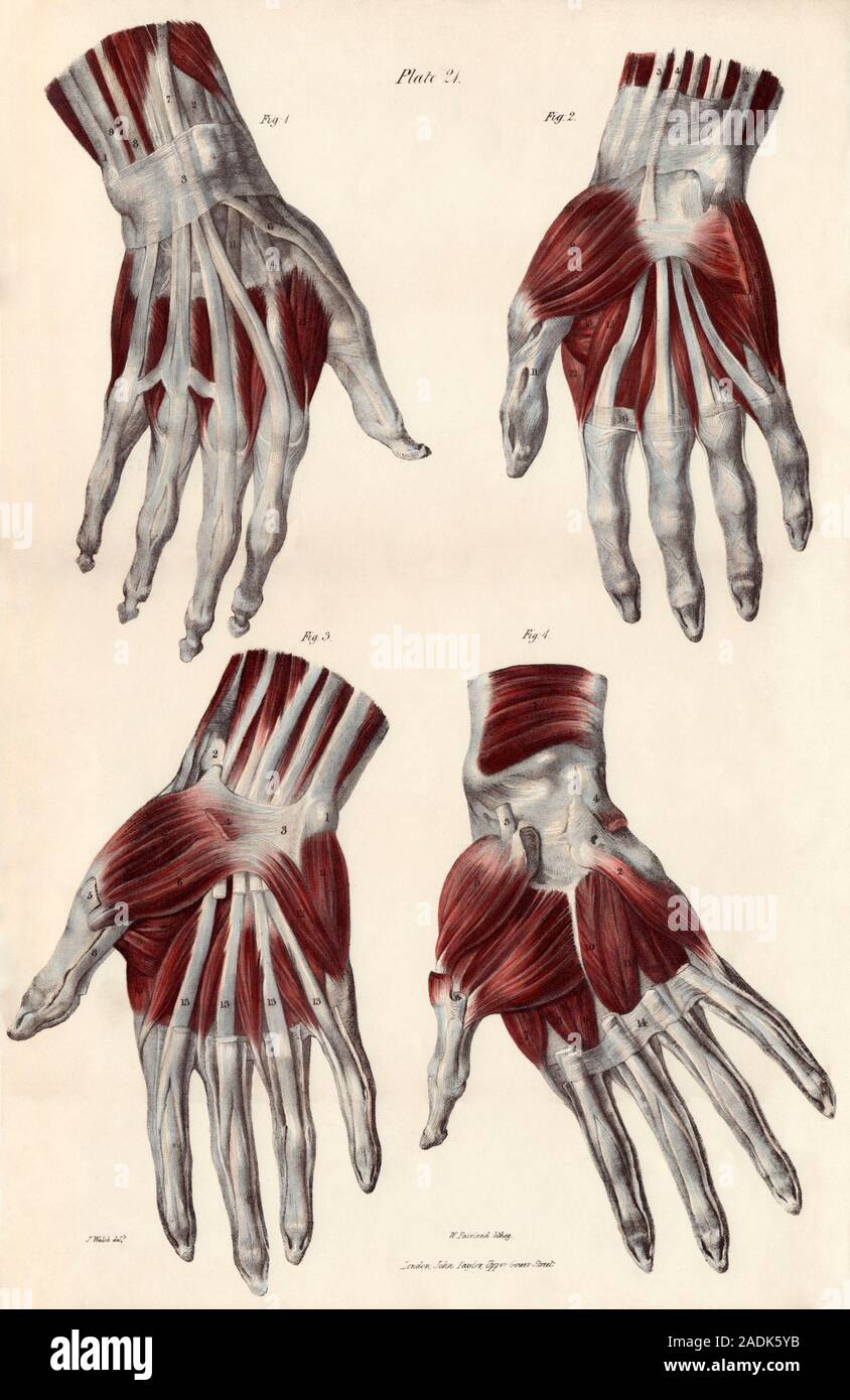 Muscles of the hand, historical artwork. At upper left is the back of a ...