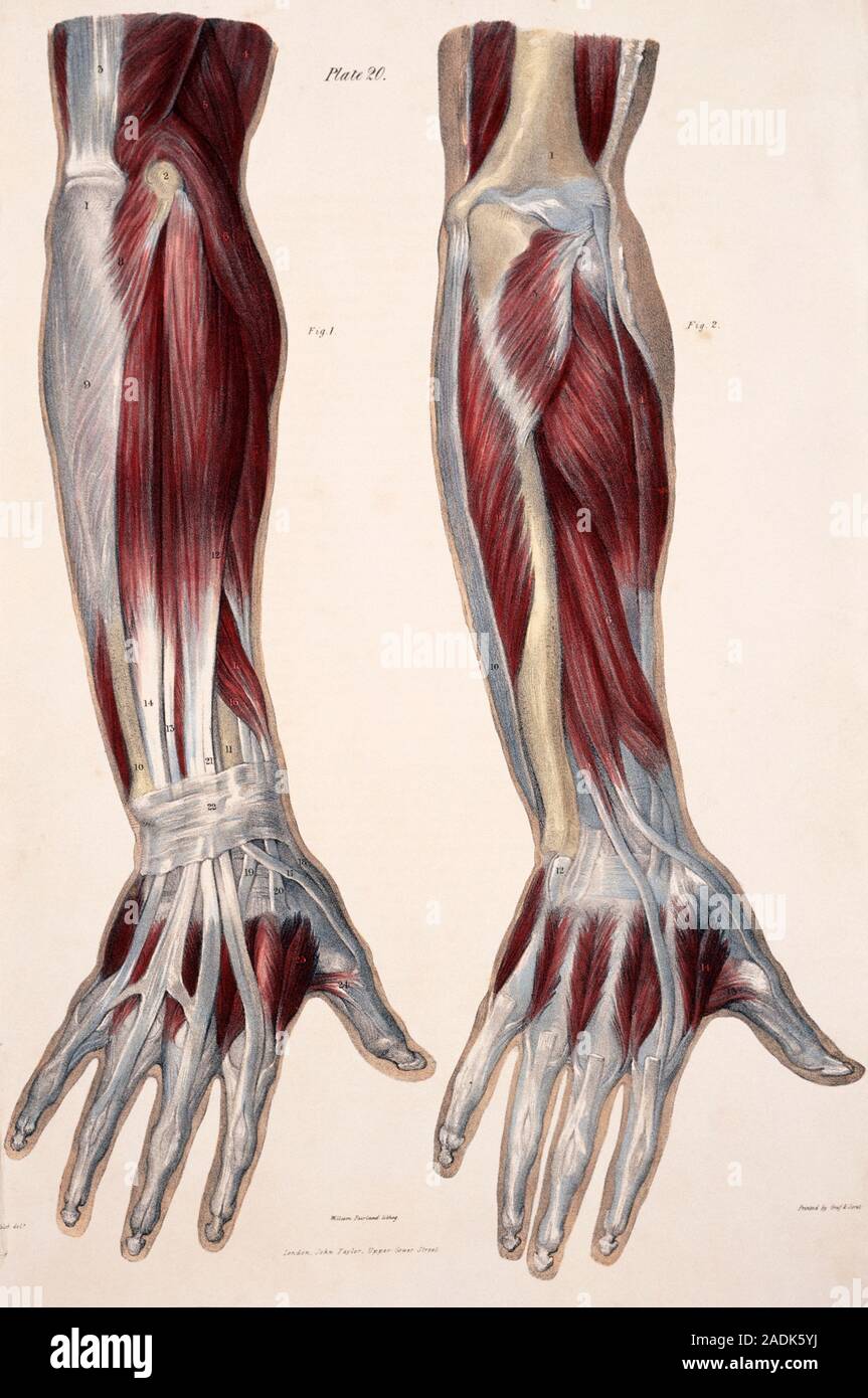 Muscles of the forearm, historical artwork. The figure at left shows ...