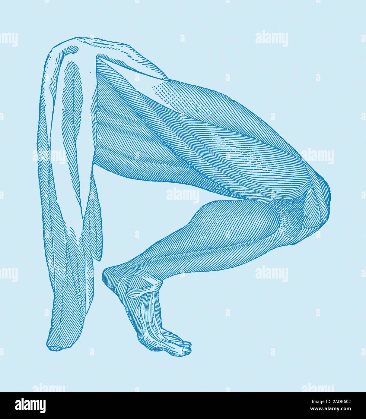 Leg muscles. Historical artwork of the muscles of the leg, revealed by ...