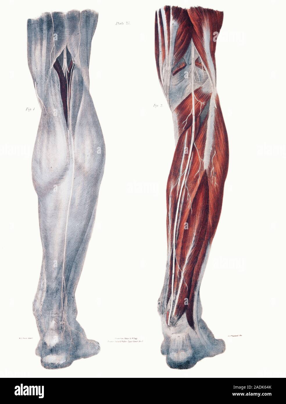 Leg nerves. Historical anatomical artwork of the nerves (white) of the ...