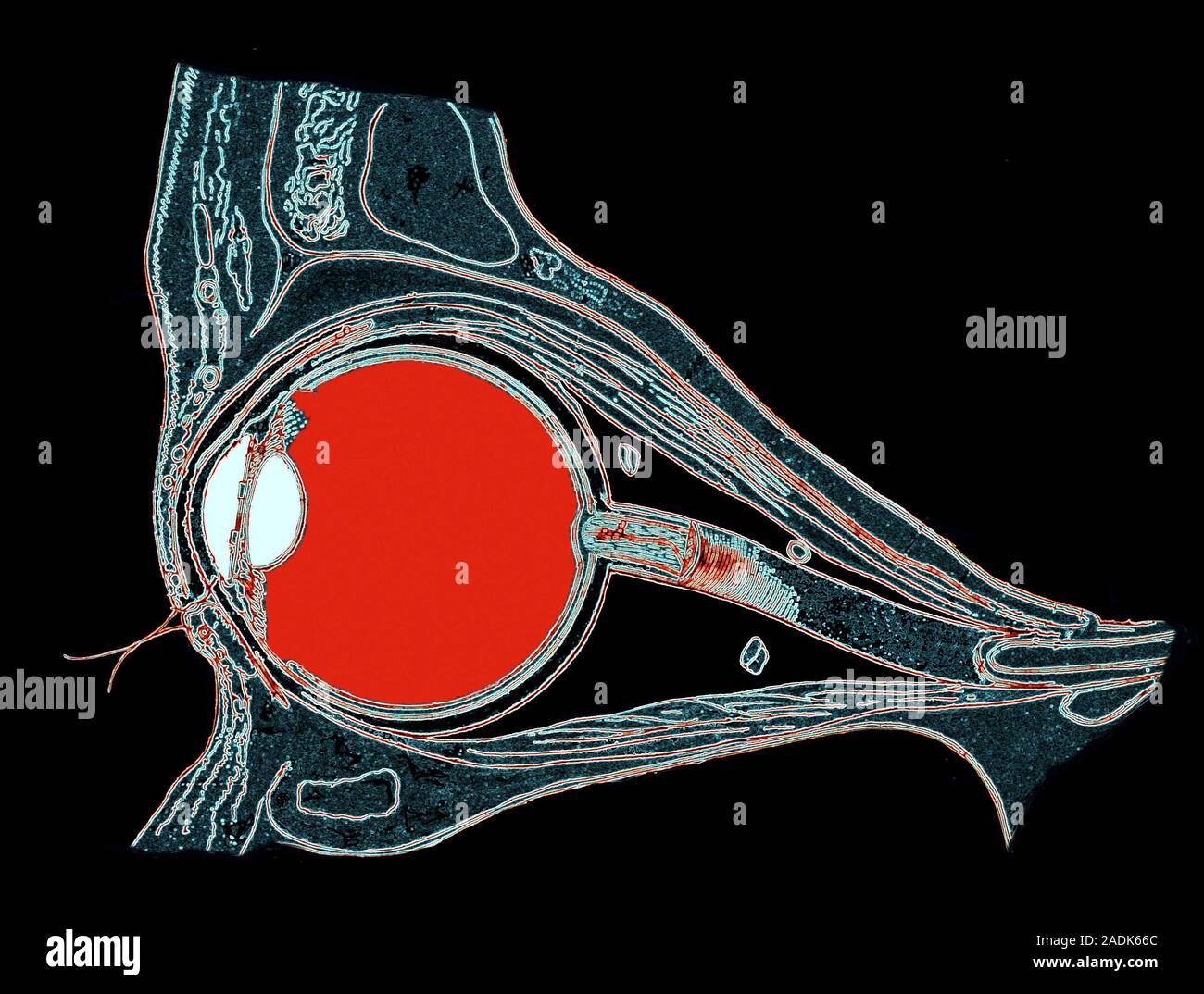 Eye. Coloured historical illustration of a cross- section through a ...