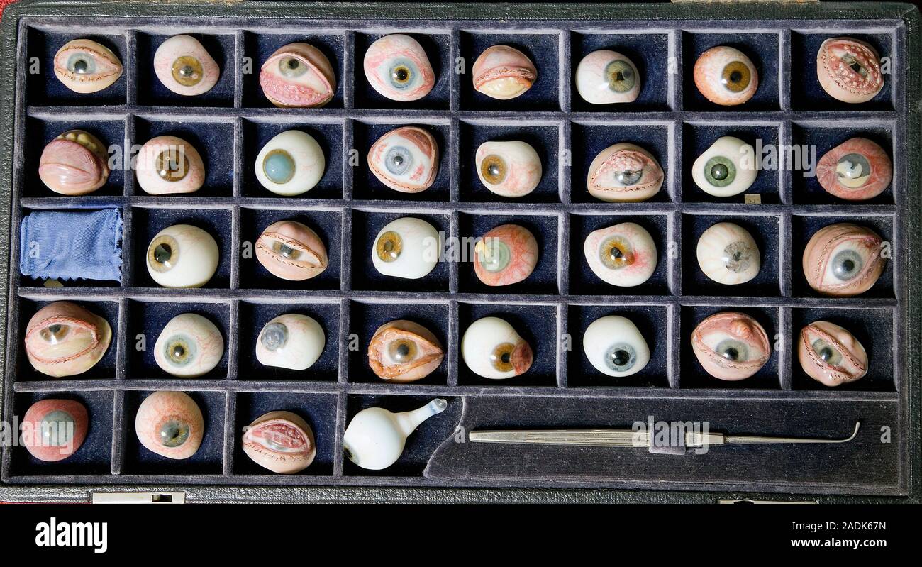 Set of glass eyeballs. Each shell illustrates a disease or abnormality ...