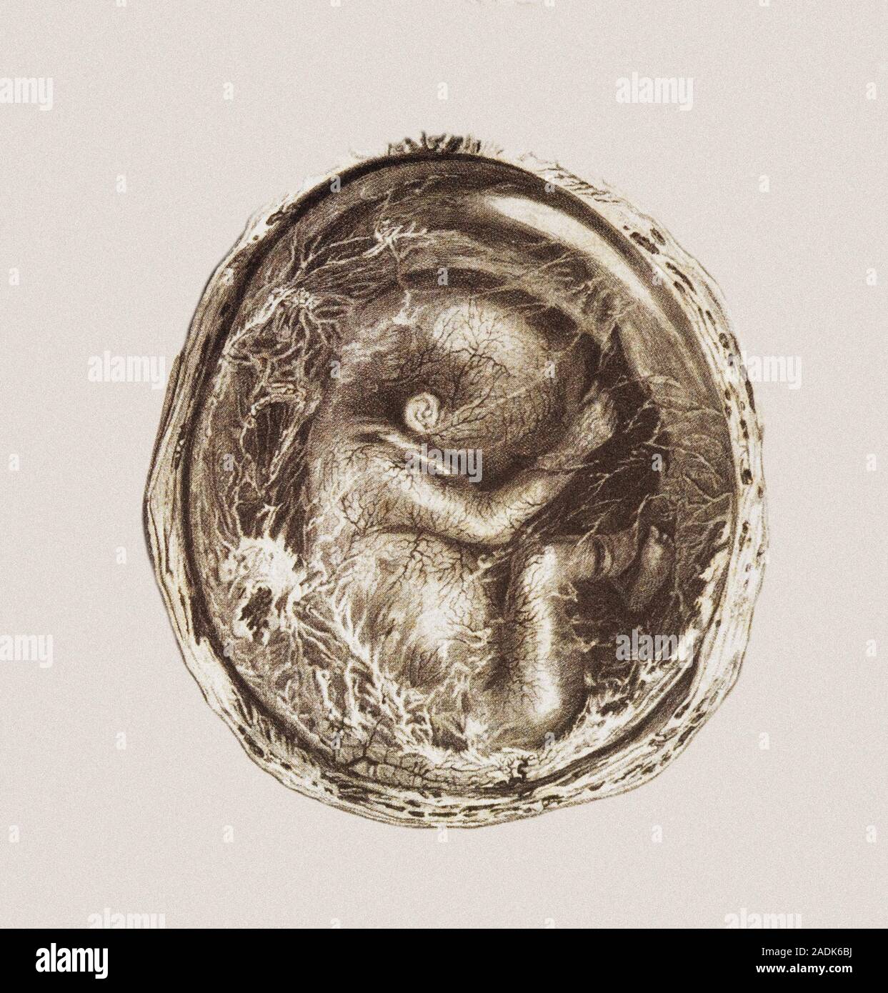 Foetus in the uterus. Artwork from William Hunter's Anatomy of the ...