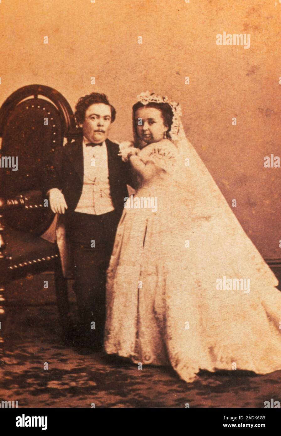 Dwarfism. Historical portrait of a couple who have the medical ...