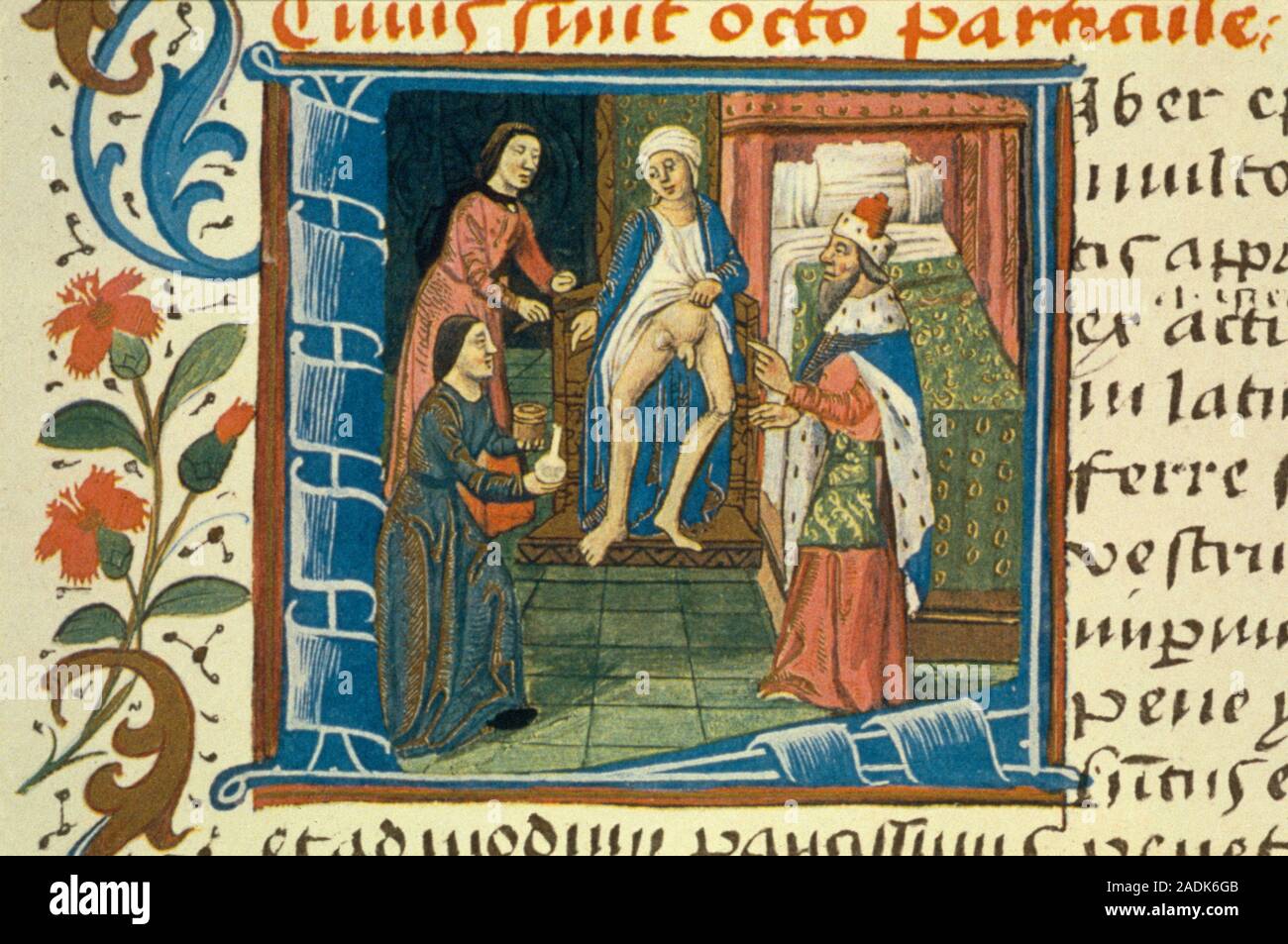 Fistula. Historical artwork of a patient suffering from a fistula, an ...