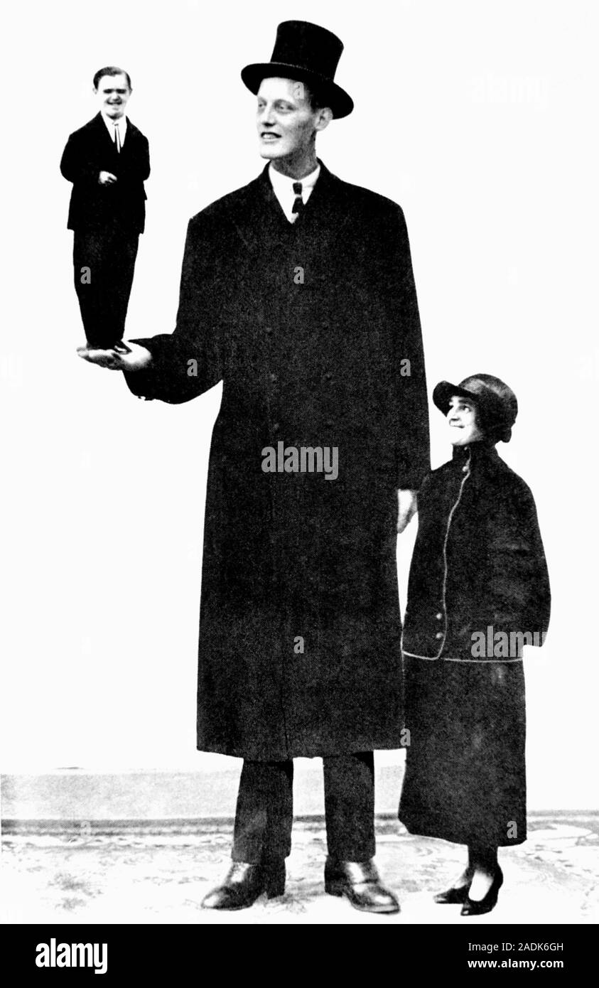 Gigantismo Y Enanismo