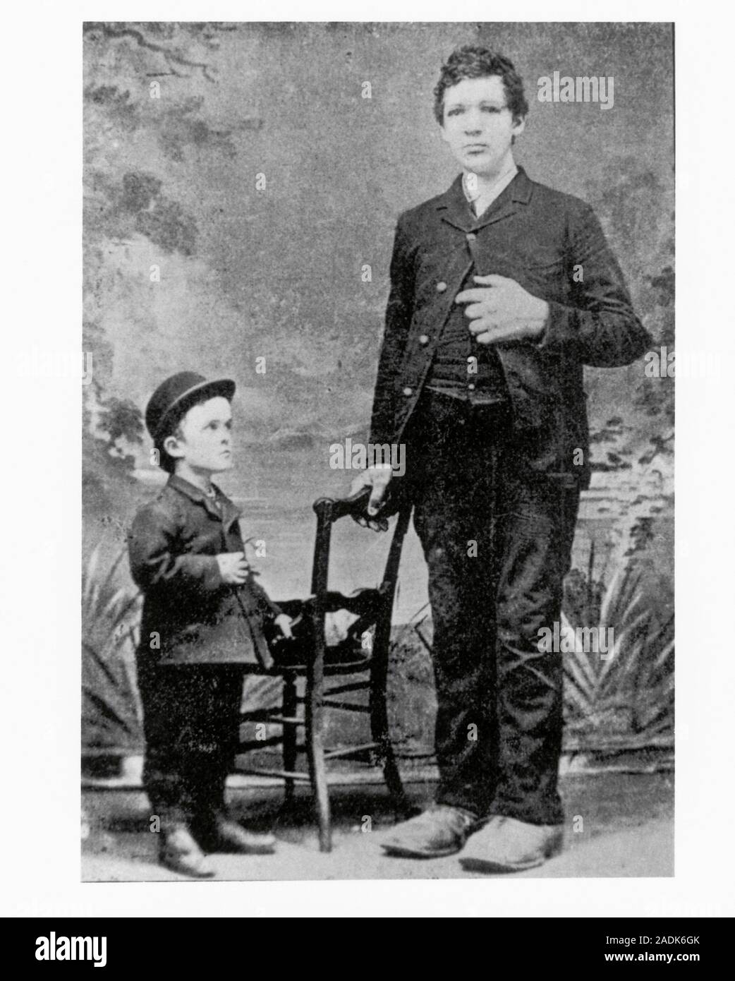 Gigantism and dwarfism. Historical image of two men suffering from ...