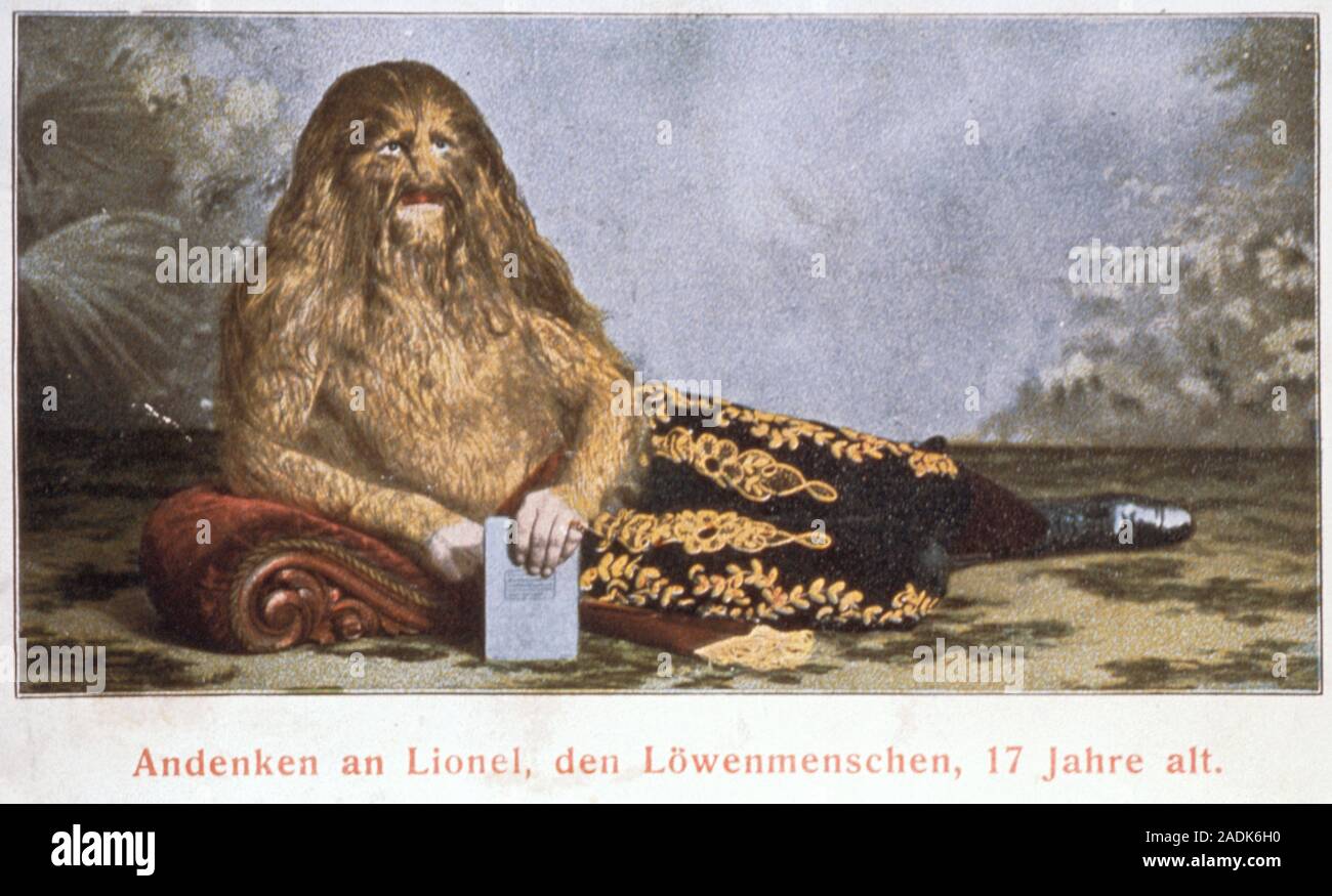 Lion-faced man. Historical artwork of Lionel the lion-faced man ...
