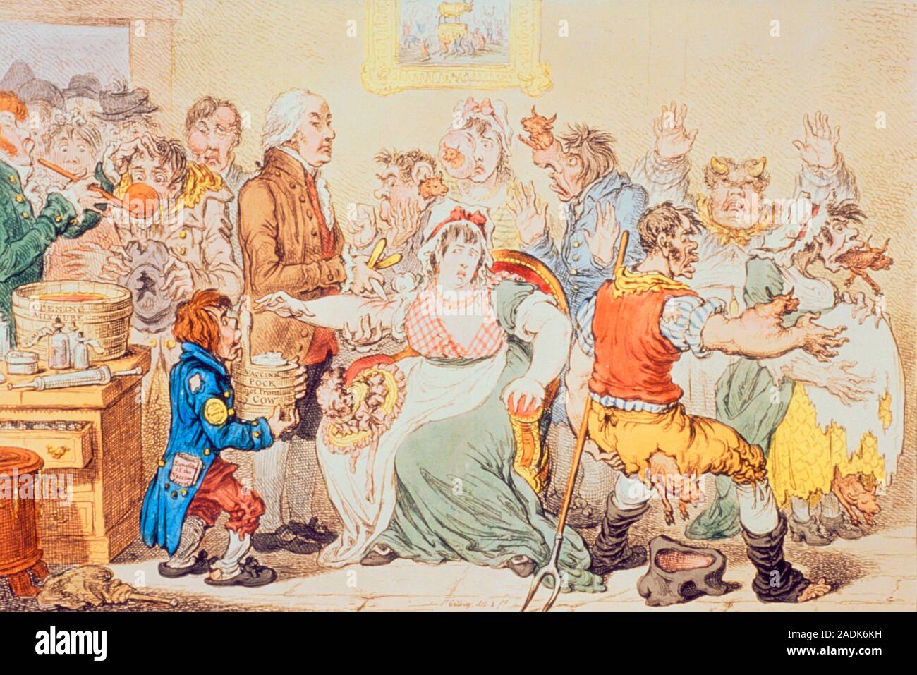 Smallpox vaccination. Historical cartoon (1802) by James Gillray ...