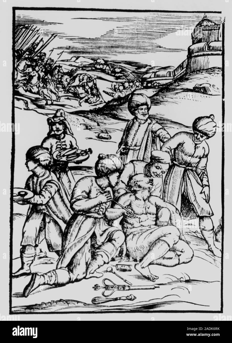 Battlefield surgery. Engraving from the 16th cent- ury of a wounded ...