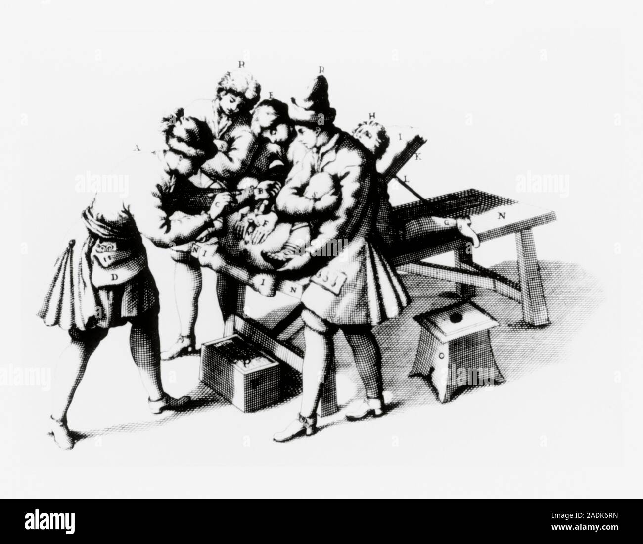 Lithotomy. 18th century engraving of a lithotomy operation being ...