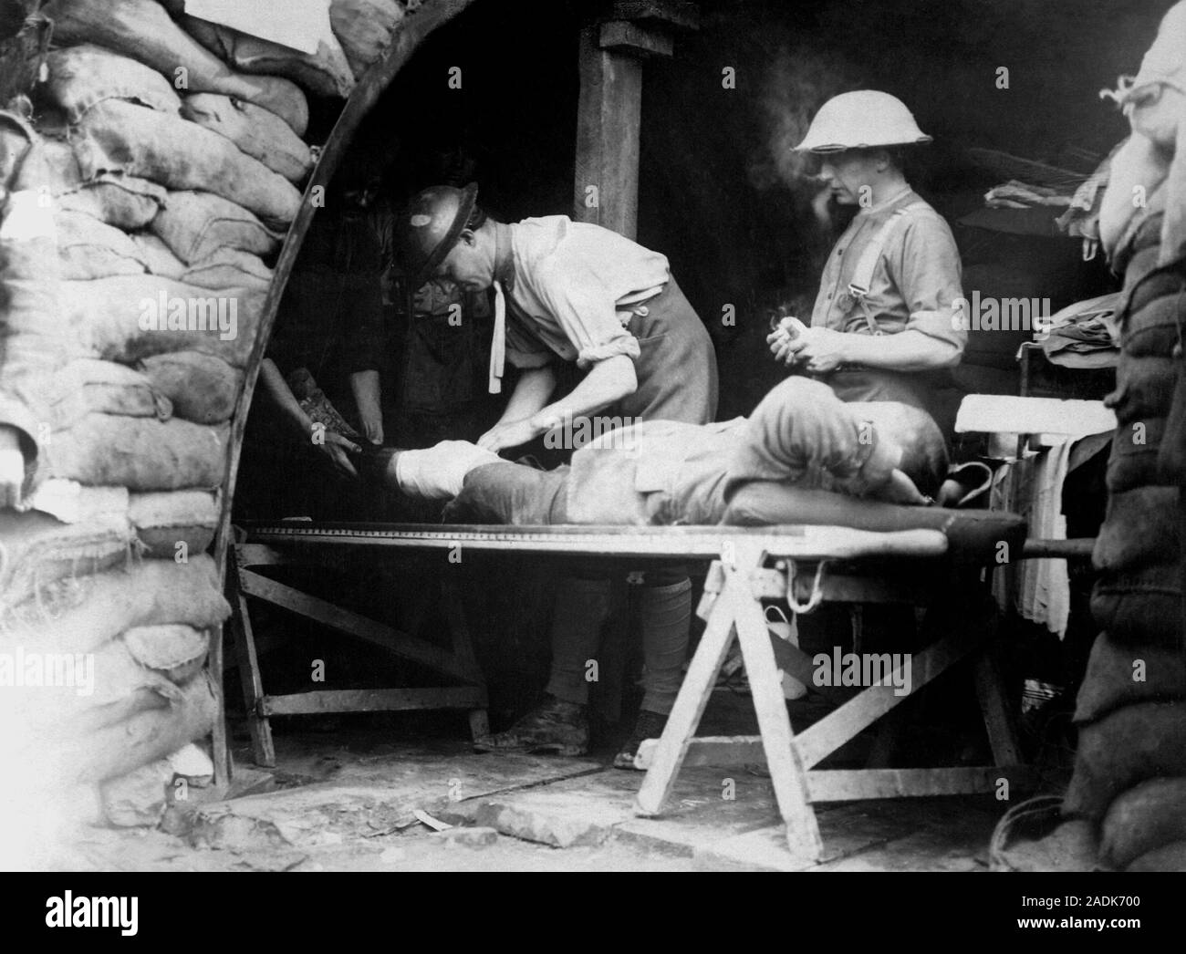 First World War medical treatment. Injured Scottish soldier having his ...