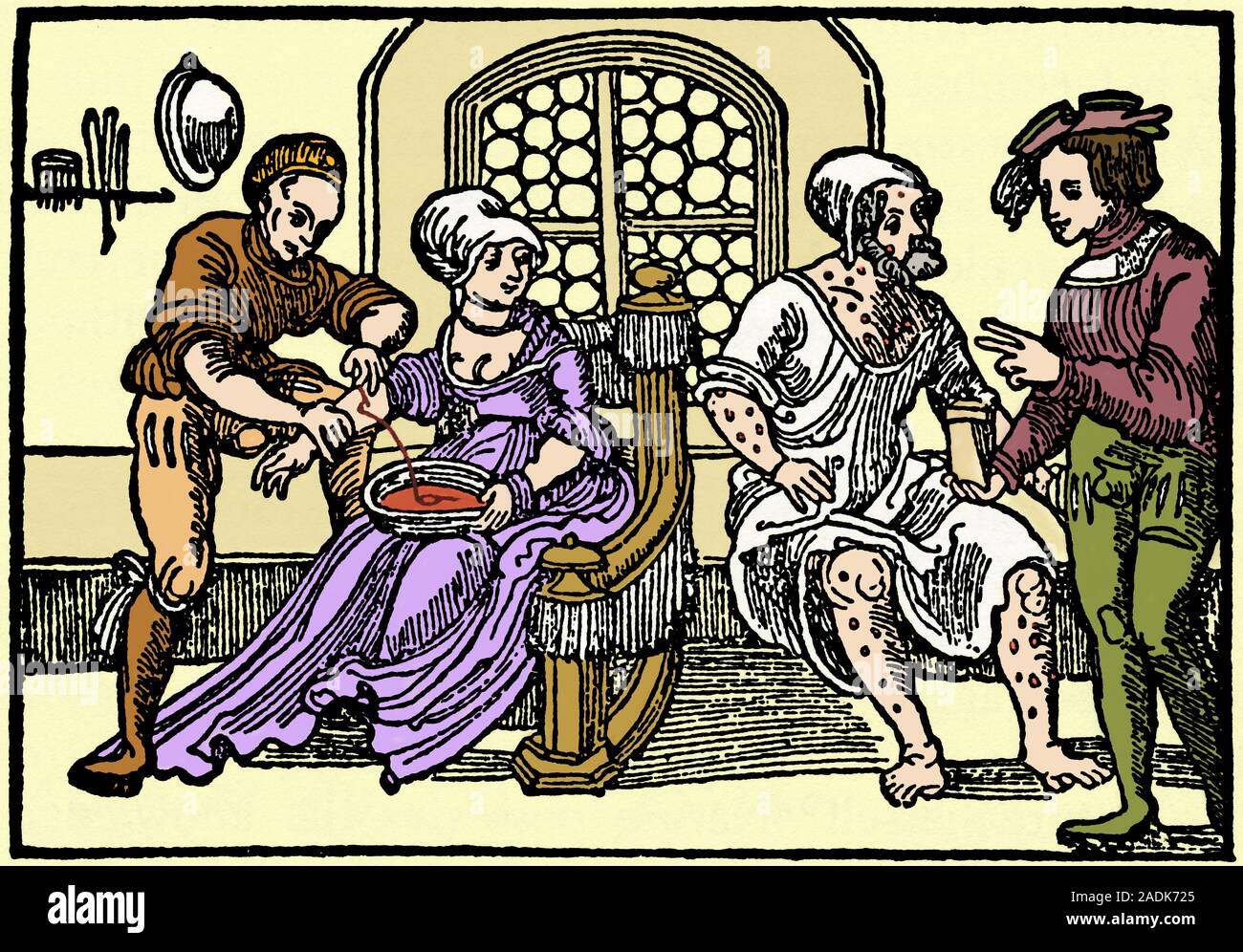 Medical treatment in a barber shop. This early 16th century woodcut ...