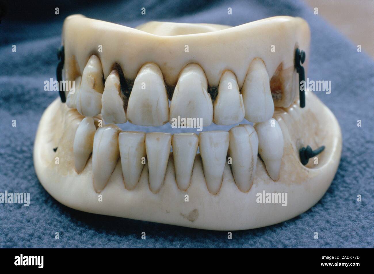 Waterloo false teeth. These Victorian dentures were made from real ...