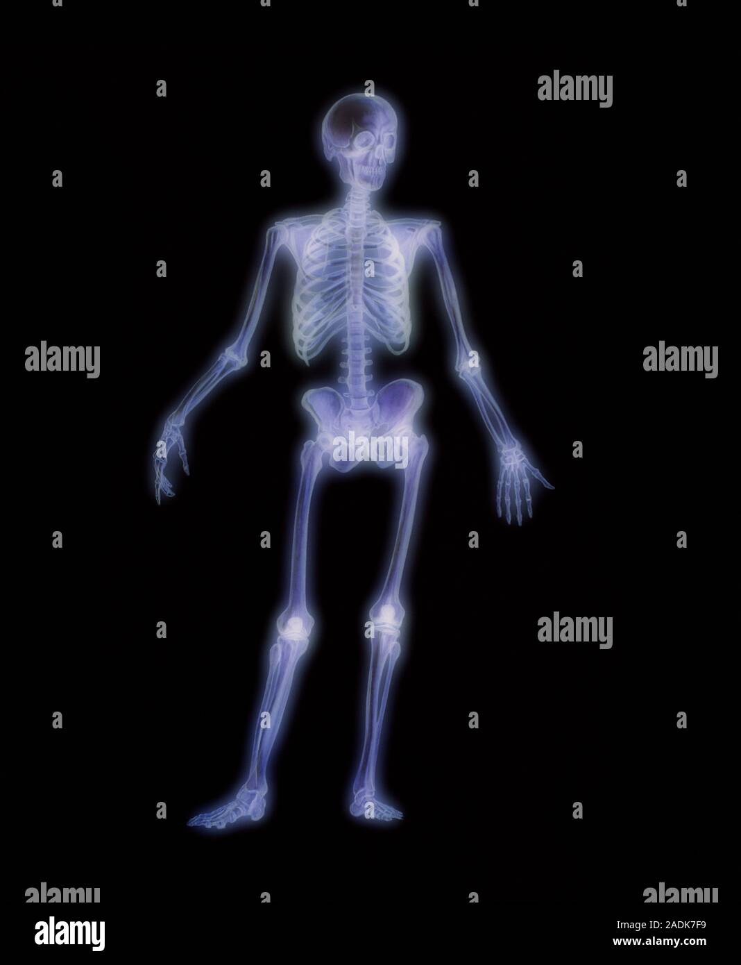Skeleton. Computer illustration based on an X-ray of a healthy human ...