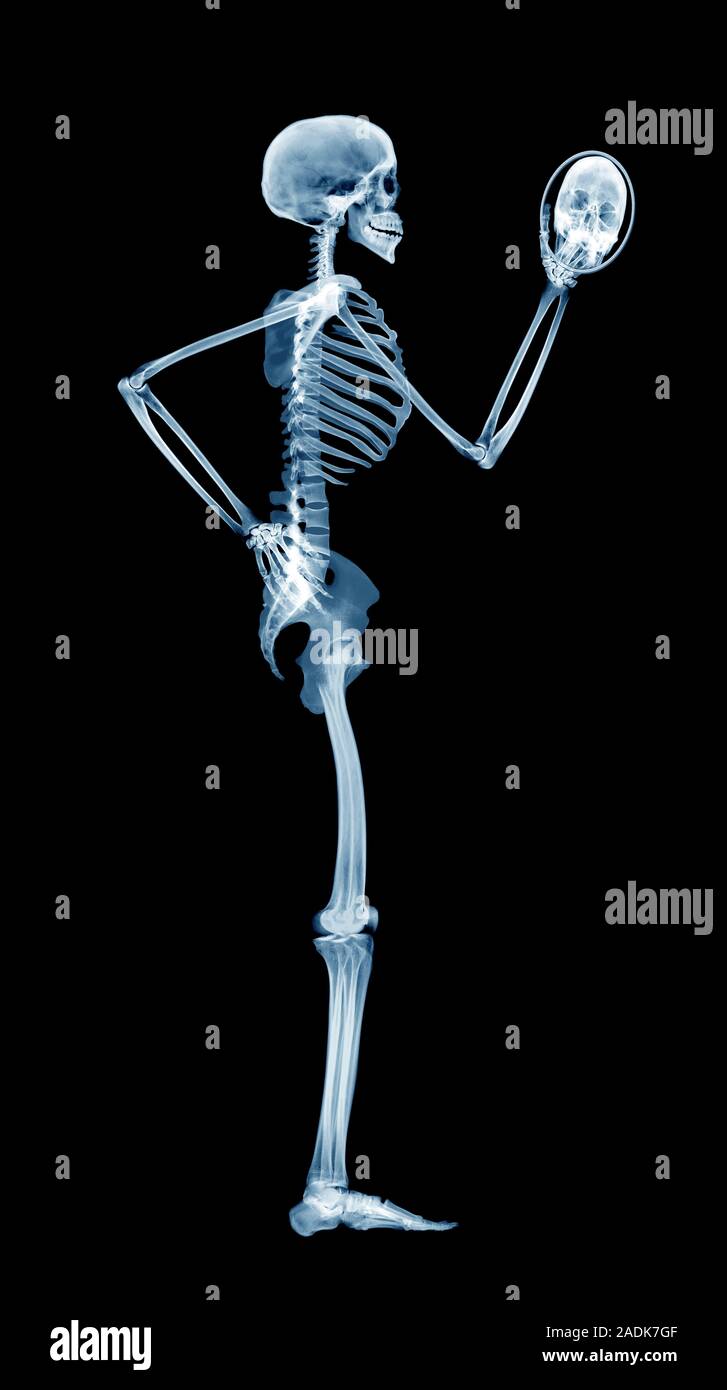 Skeleton. Computer-enhanced X-ray of a side view of a skeleton looking ...