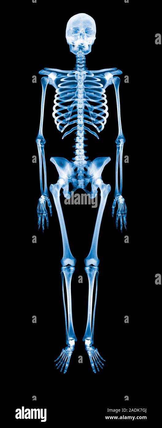 Skeleton. Frontal X-ray of a normal human skeleton. The bones of the ...