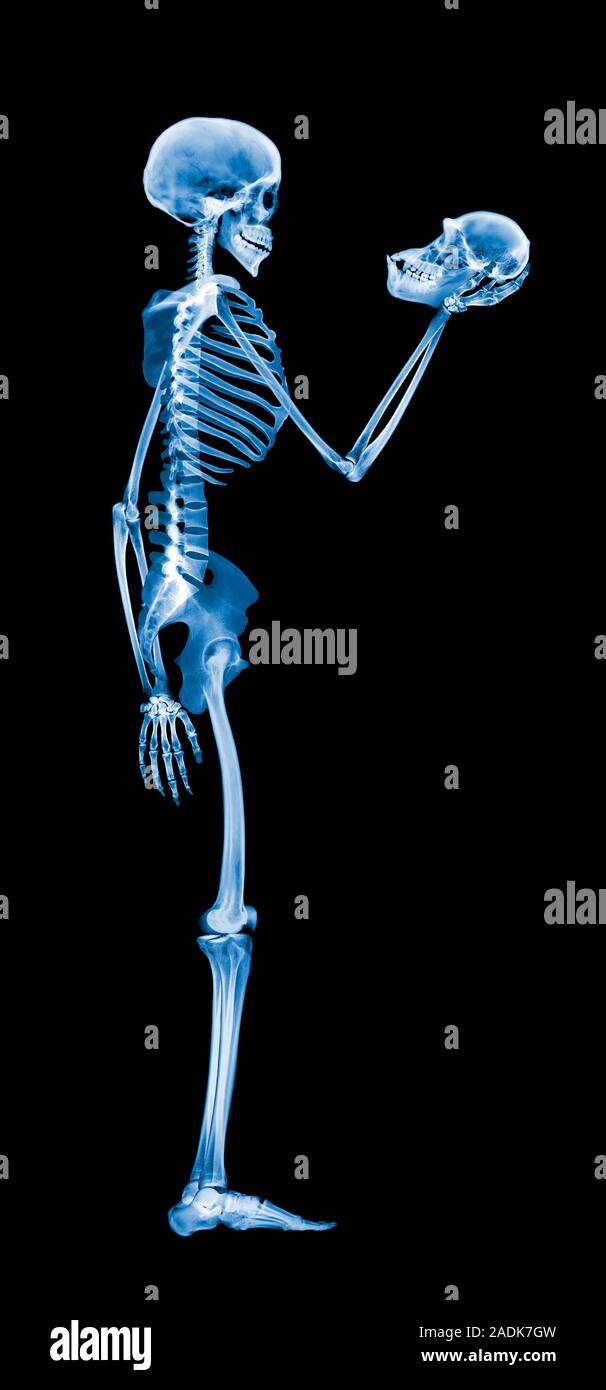 Skeleton. Computer-enhanced X-ray of a sagittal (side) view of a ...