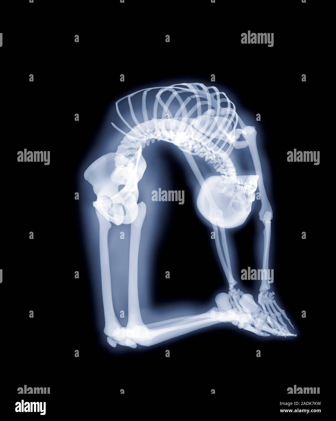 Backward bend. Computer artwork based on an X-ray of a person bending ...