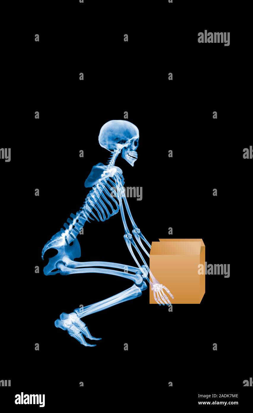 Skeleton lifting a box correctly. Side view X- ray. This image shows ...