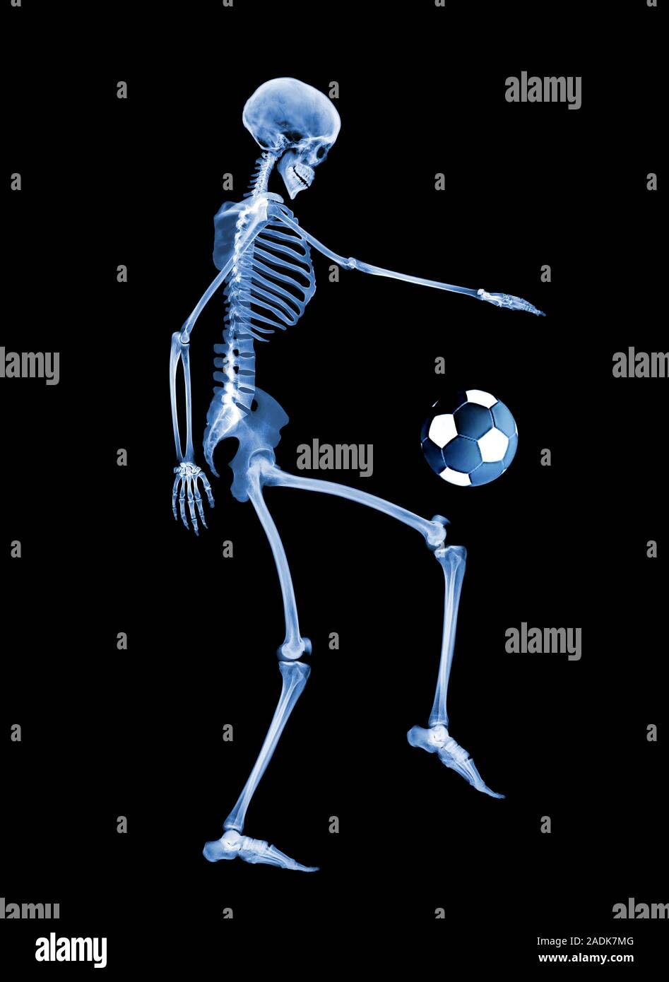 Skeleton playing football. Computer enhanced X- ray of a skeleton ...