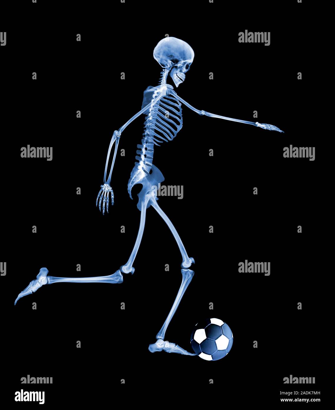Skeleton playing football. Computer enhanced X- ray of a skeleton ...