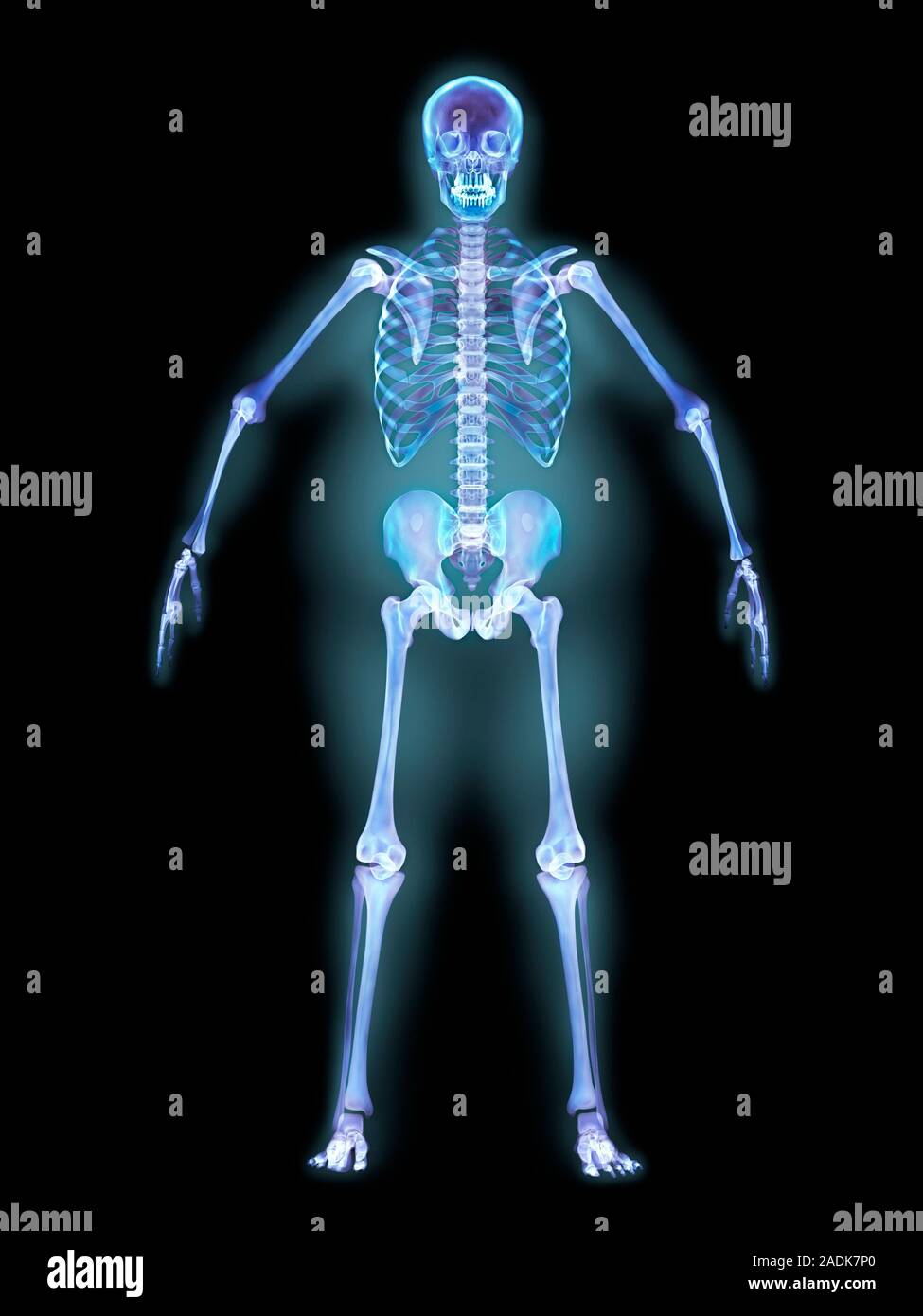 Obesity. Enhanced X-ray of an obese man Stock Photo - Alamy