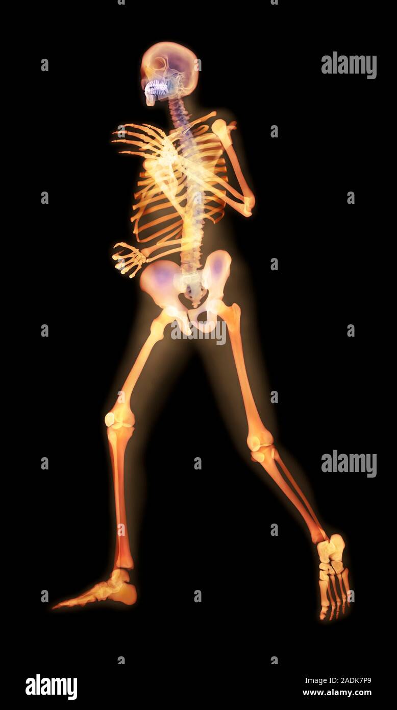 Runner, X-ray artwork Stock Photo - Alamy
