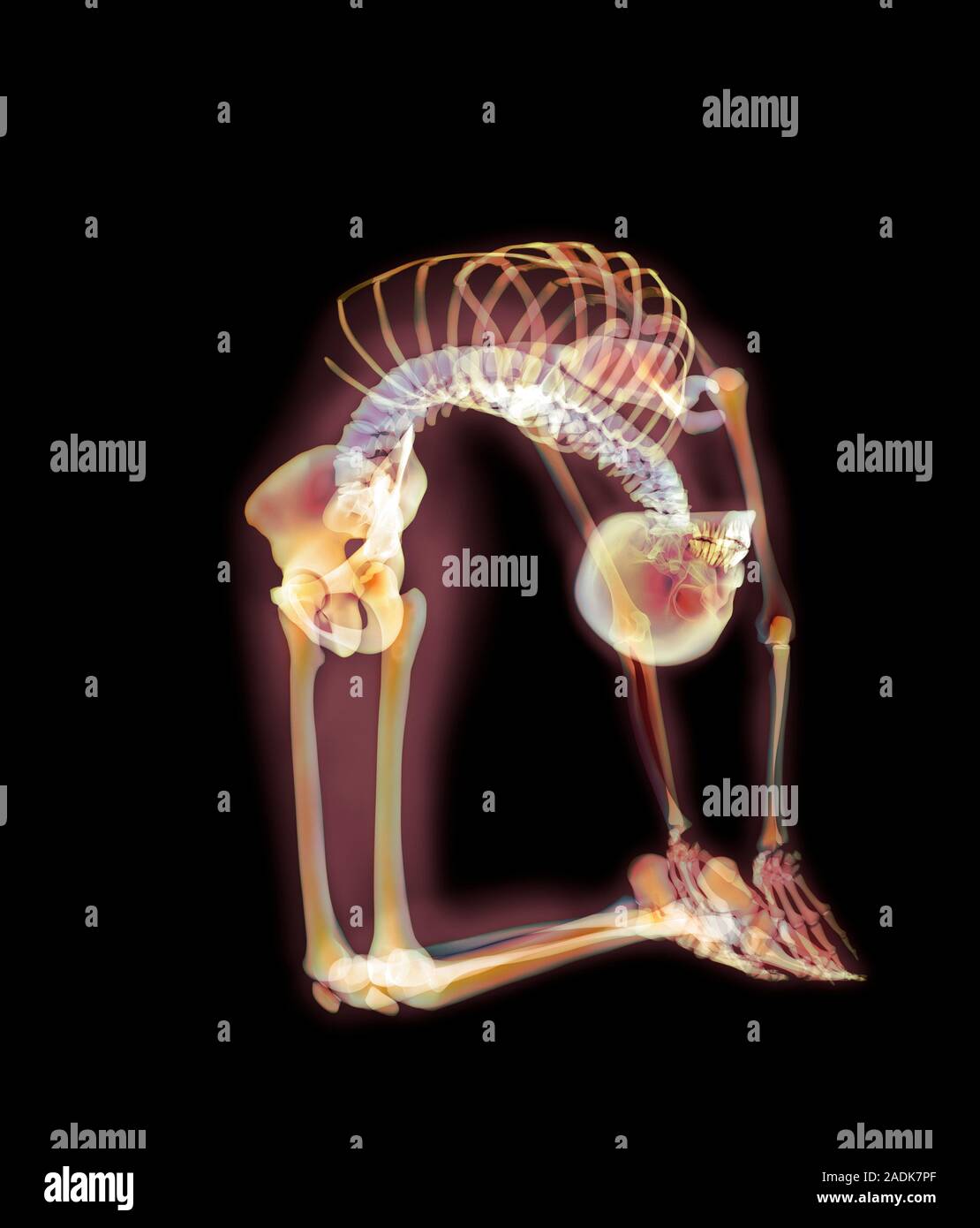 Backward bend. Enhanced X-ray of a person bending over backwards to ...