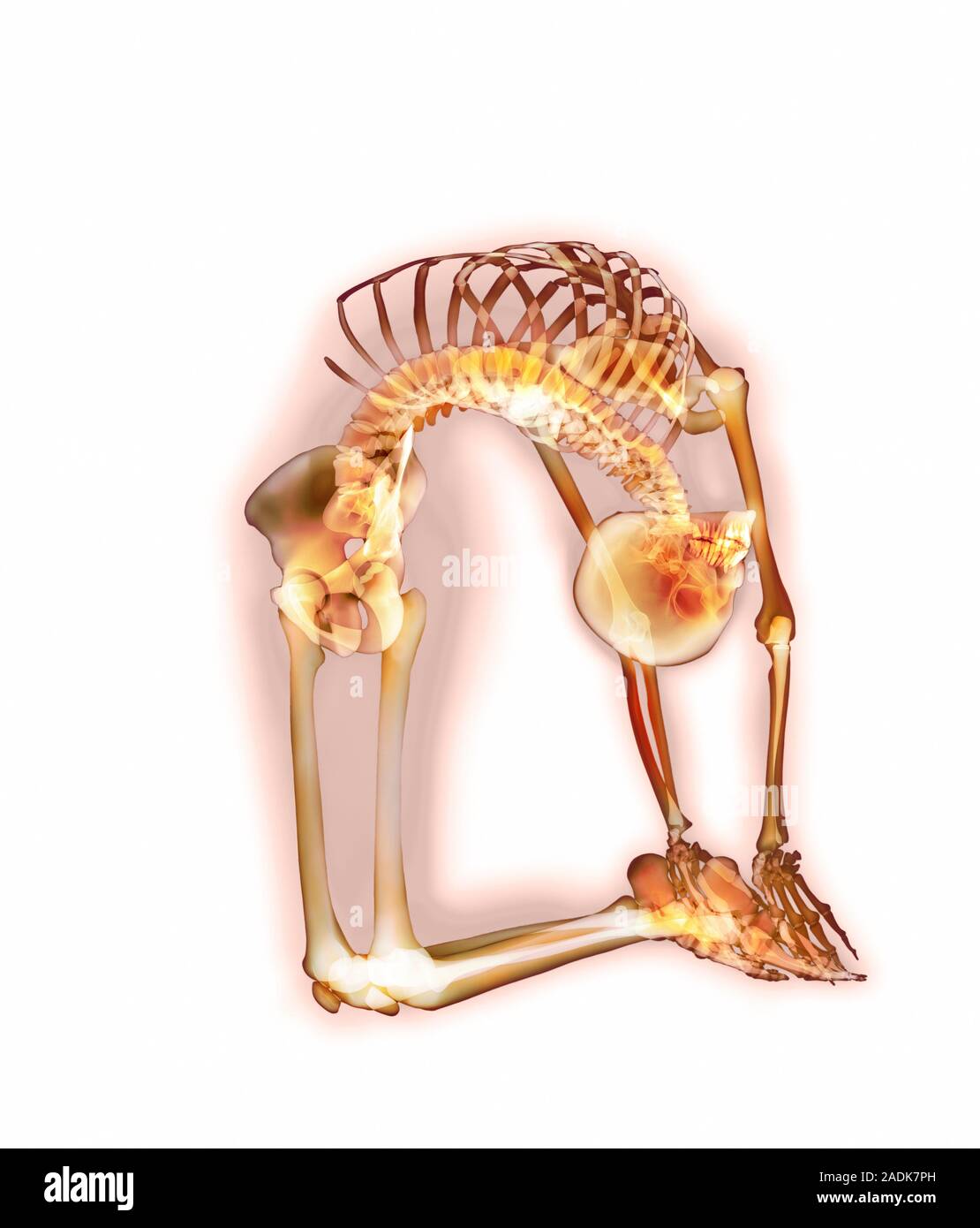 Backward bend. Enhanced X-ray of a person bending over backwards to ...