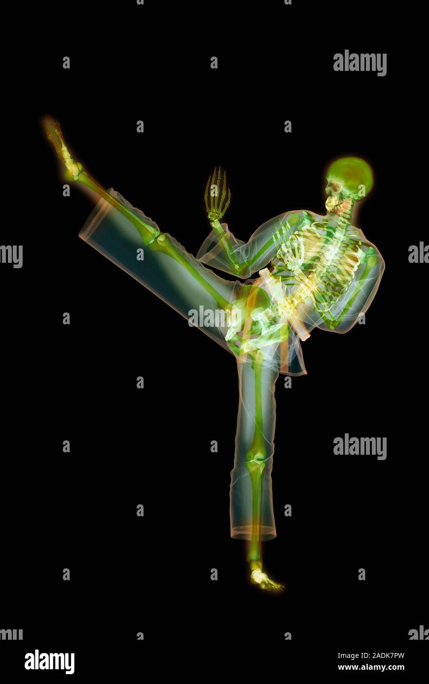 Martial arts kick. Enhanced X-ray of a person performing a high kick ...