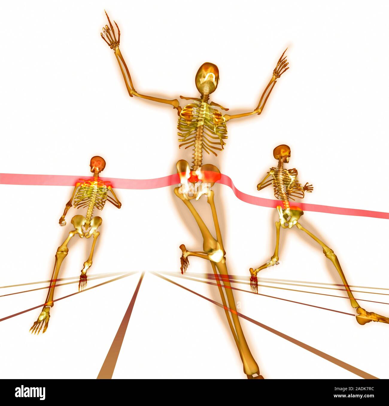 Athletes finishing a race. Enhanced X-ray of a group of athletes ...