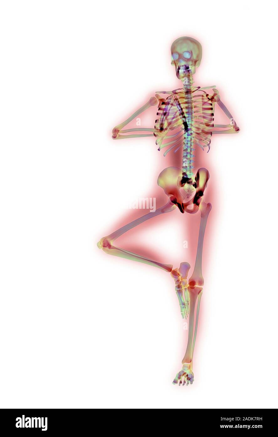 Yoga position. Enhanced X-ray of a person standing in the tree or one ...
