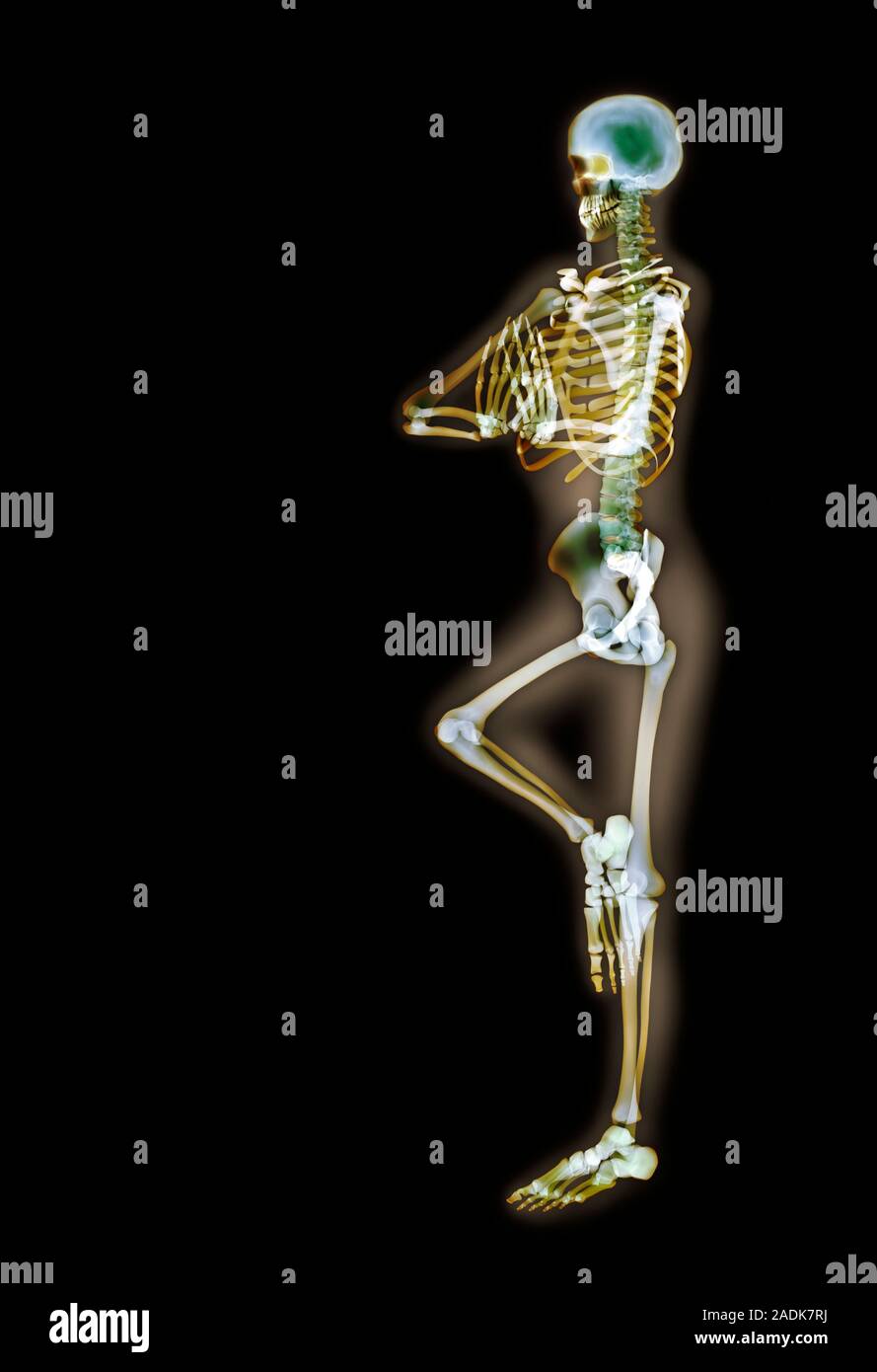 Yoga position. Enhanced X-ray of a person standing in the tree or one ...