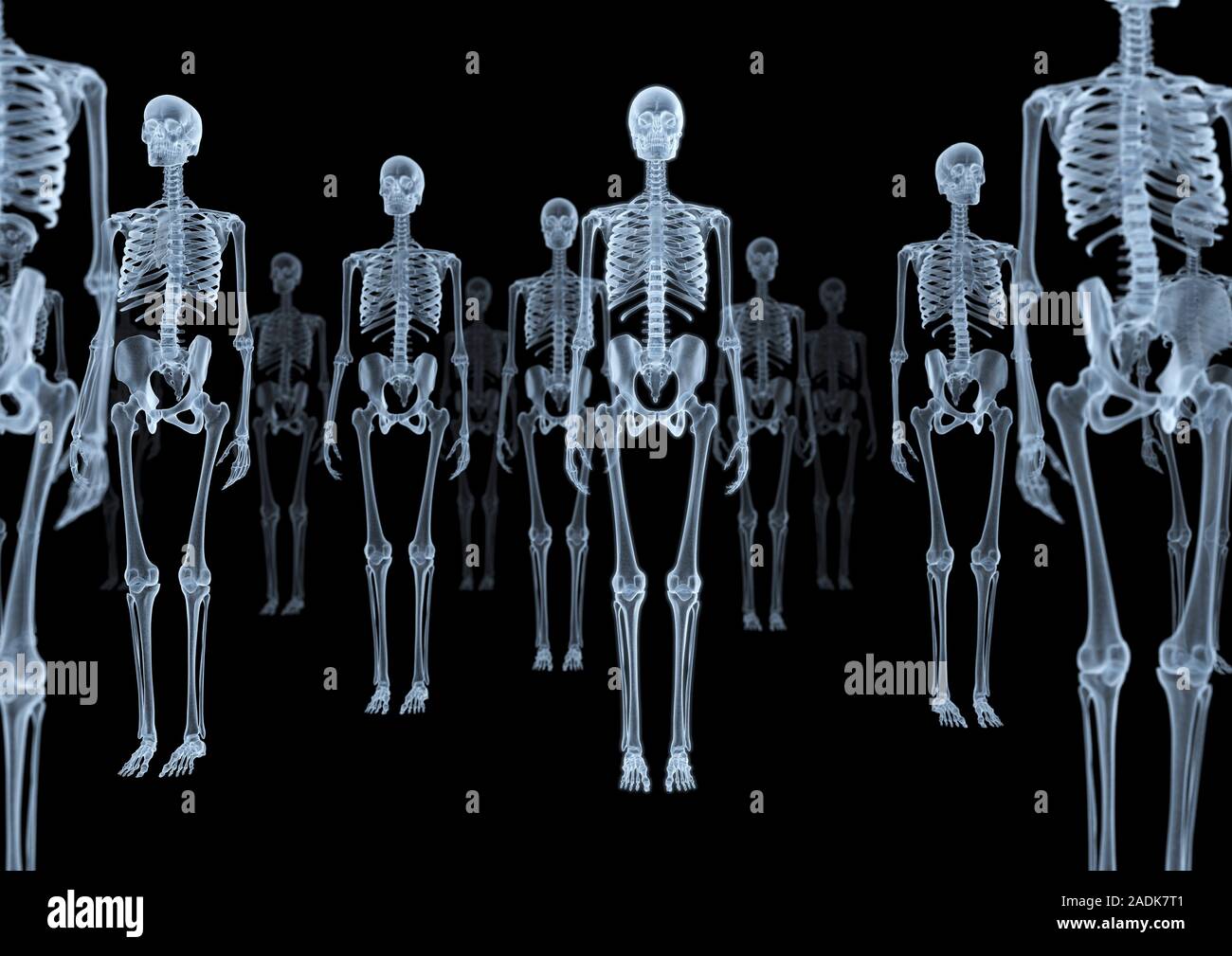 Skeleton crowd. Computer X-ray artwork of a group of human skeletons ...